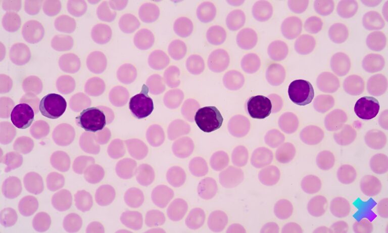 Limfocyty – jak interpretować wyniki badań krwi? - Nexmed